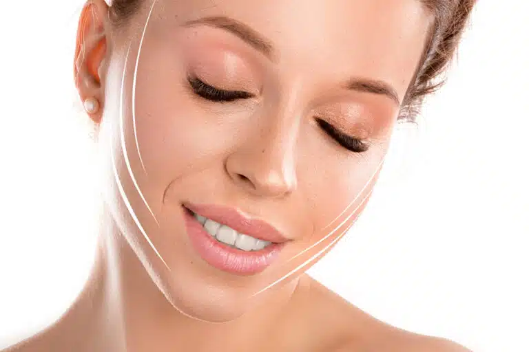 Explore Non-Invasive Buccal Fat Pad Treatment Alternatives